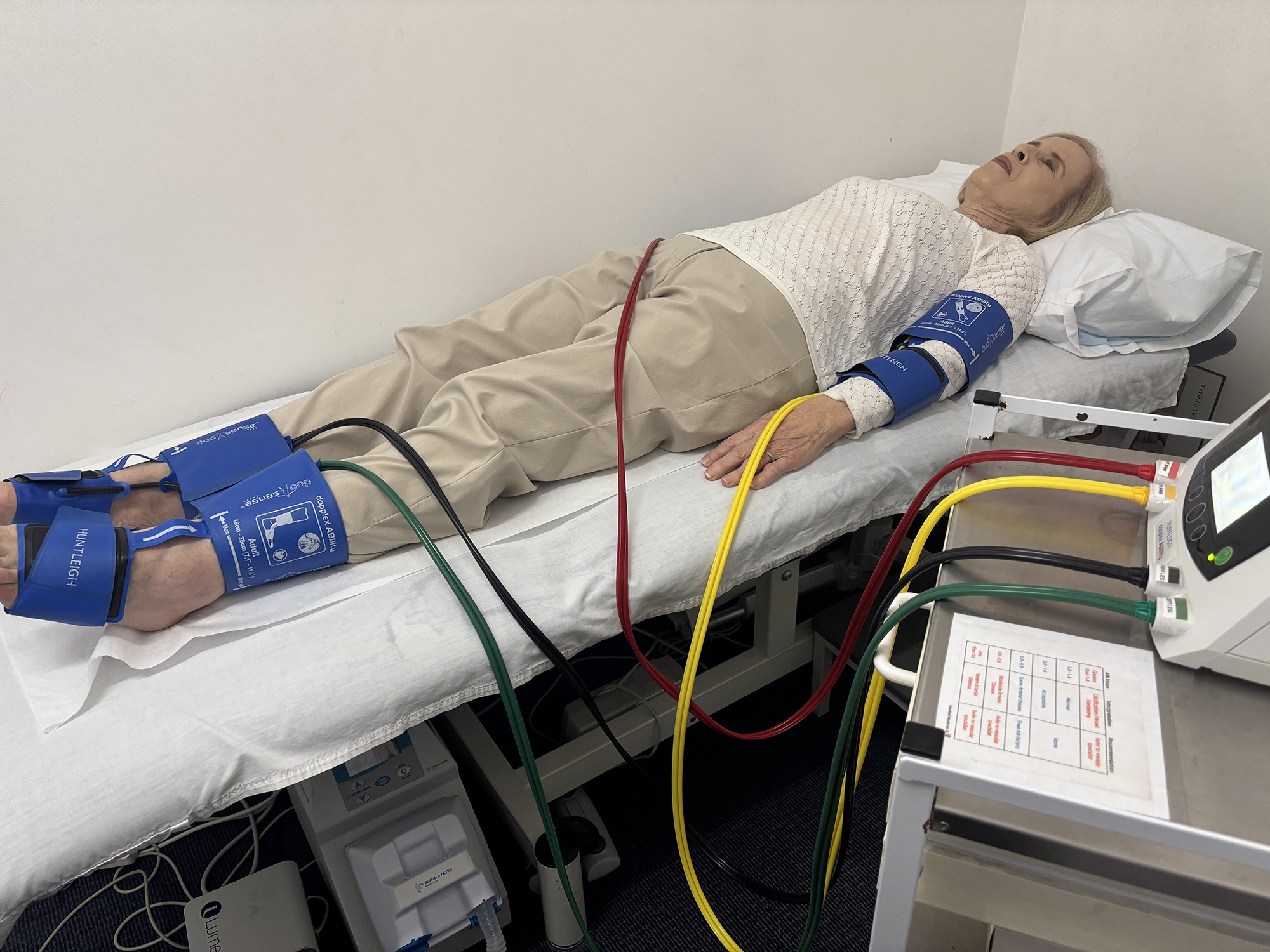 Ankle Brachial Index (ABI) Test - PAD Screening at GVSL